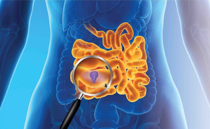 SpeeDx | EntericPlex Bacteria II